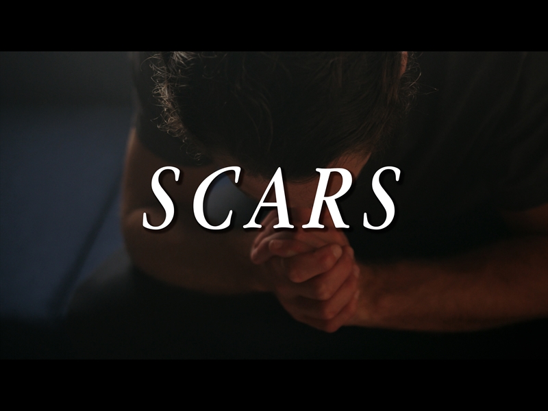 Scars | Rype.tv | WorshipHouse Media