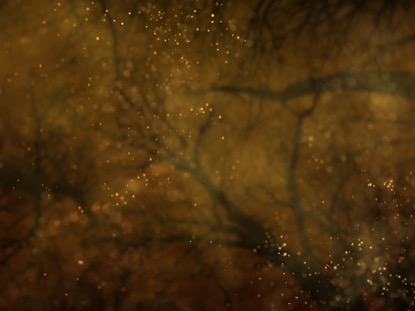 Winter Forest Mega Bundle | Social Light Multimedia | WorshipHouse Media